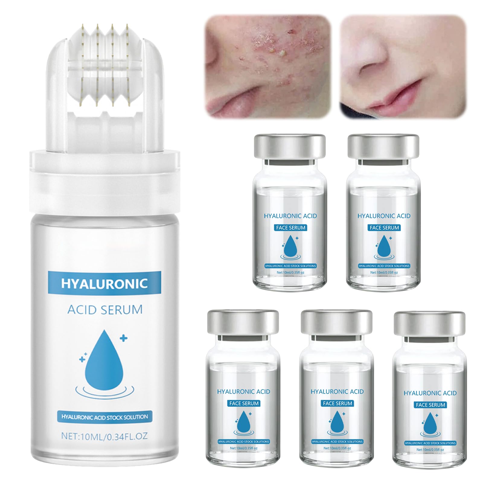 Colaren 6 PCS Beauty Micro Infusion Facial System, Skin Micro Infusion ...