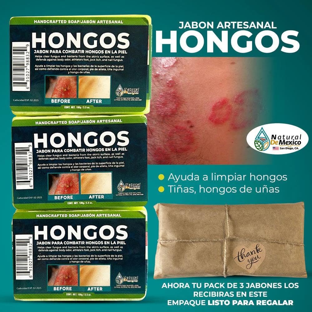 Amazon.com : Hongos Jabon 3 Pack Anti Fungal Soap Bar Fungus : Health ...