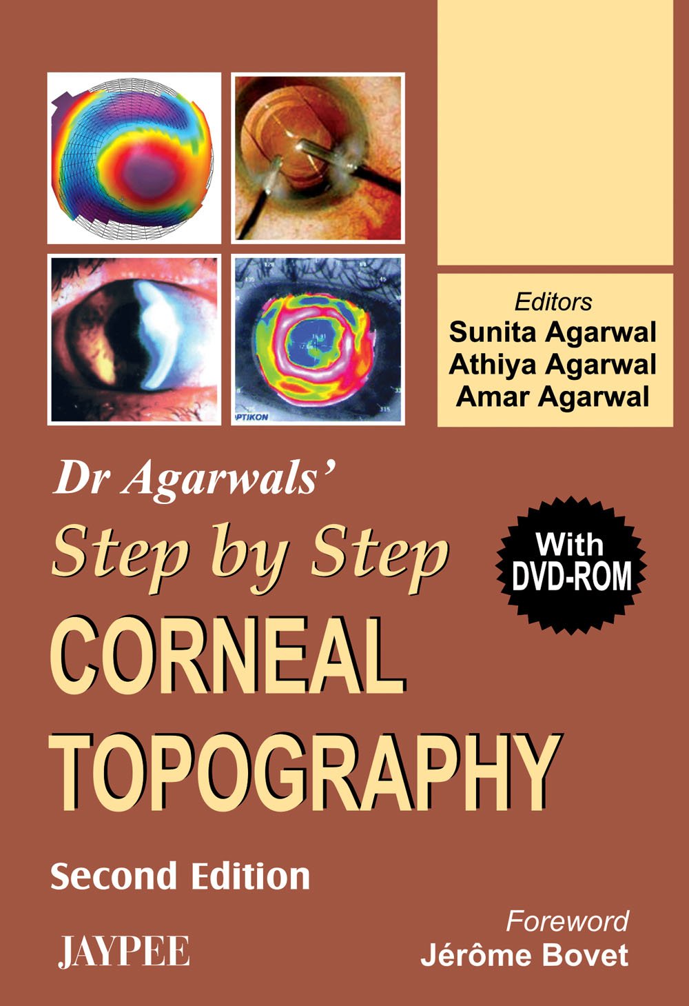 Buy DR.AGARWALS' STEP BY STEP CORNEAL TOPOGRAPHY WITH DVD-ROM Book ...