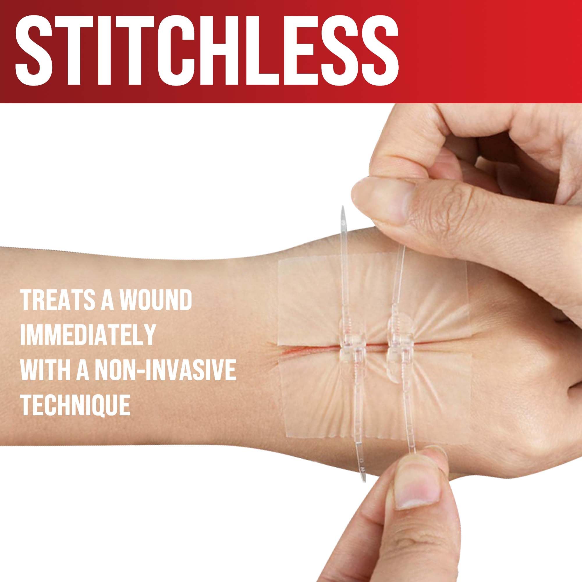 Snapklik.com : Emergency Wound Closure Strip - Laceration Closure Kit ...