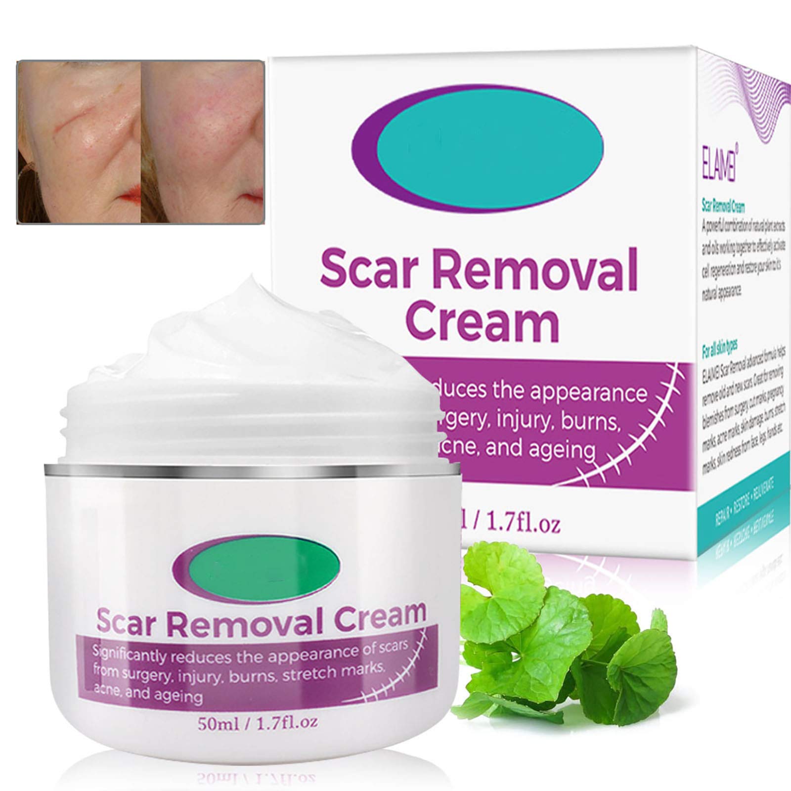 Buy Cream, Mark Removal Cream Gentle Formula with Extract Ingredient ...
