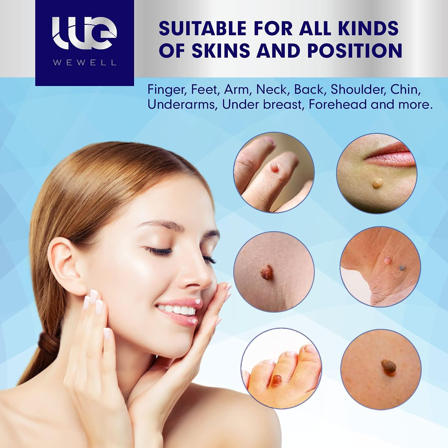 Wewell Skin Tag Removal Kit Standard and Micro Skin Tag Removal kit ...