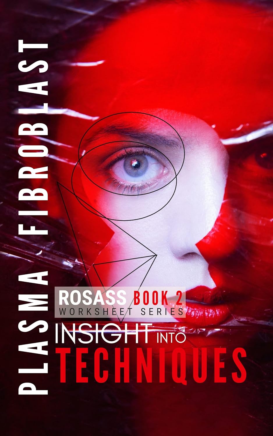 Techniques: Plasma Fibroblast Rosass insight into mapping (Learn All ...