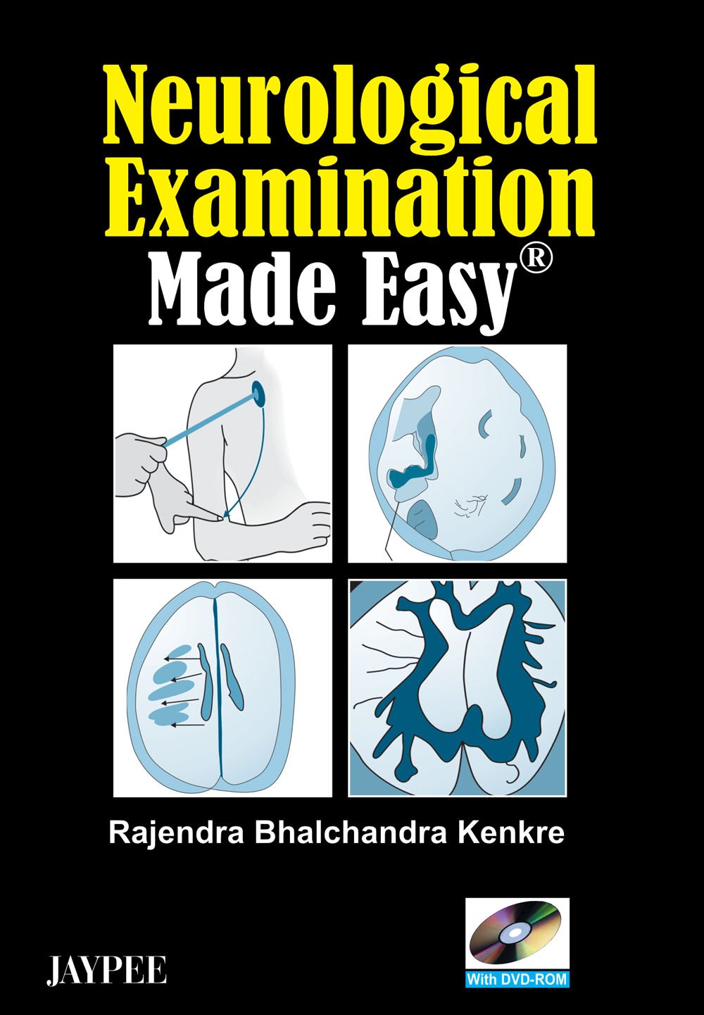 Neurological Examination Made Easy: 9788184483703: Medicine & Health ...