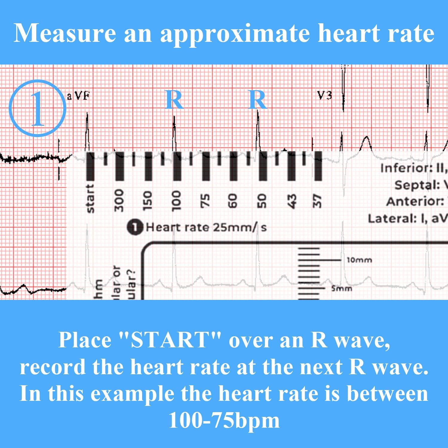 ECG 7 Step Ruler, 2PCS ECG 7 Step Ruler for ECG/EKG Ecuador | Ubuy