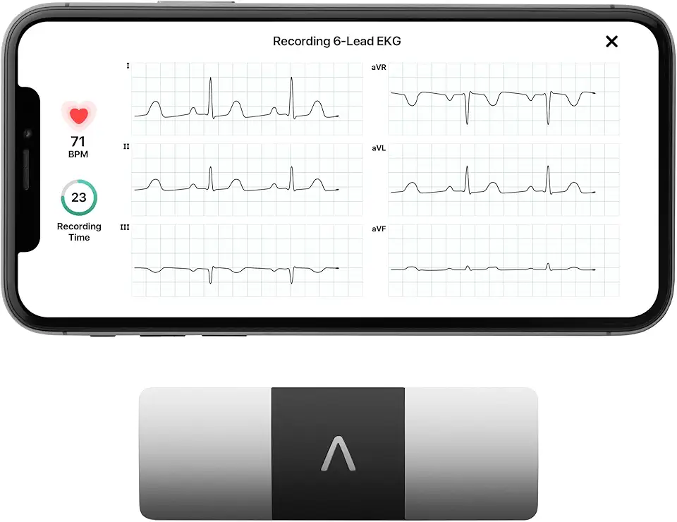 Can Ecgs Be Done During Pregnancy: What You Need To Know | ShunChild