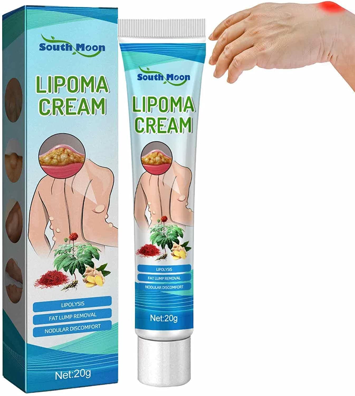 Lumpfree Lipoma Removal Cream Herbal Lipoma Lumps Removal Cream Lipoma ...