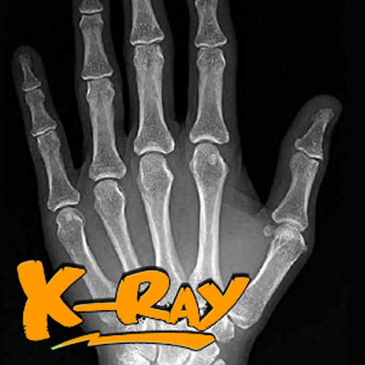 Xray Droid Scanner - App on Amazon Appstore
