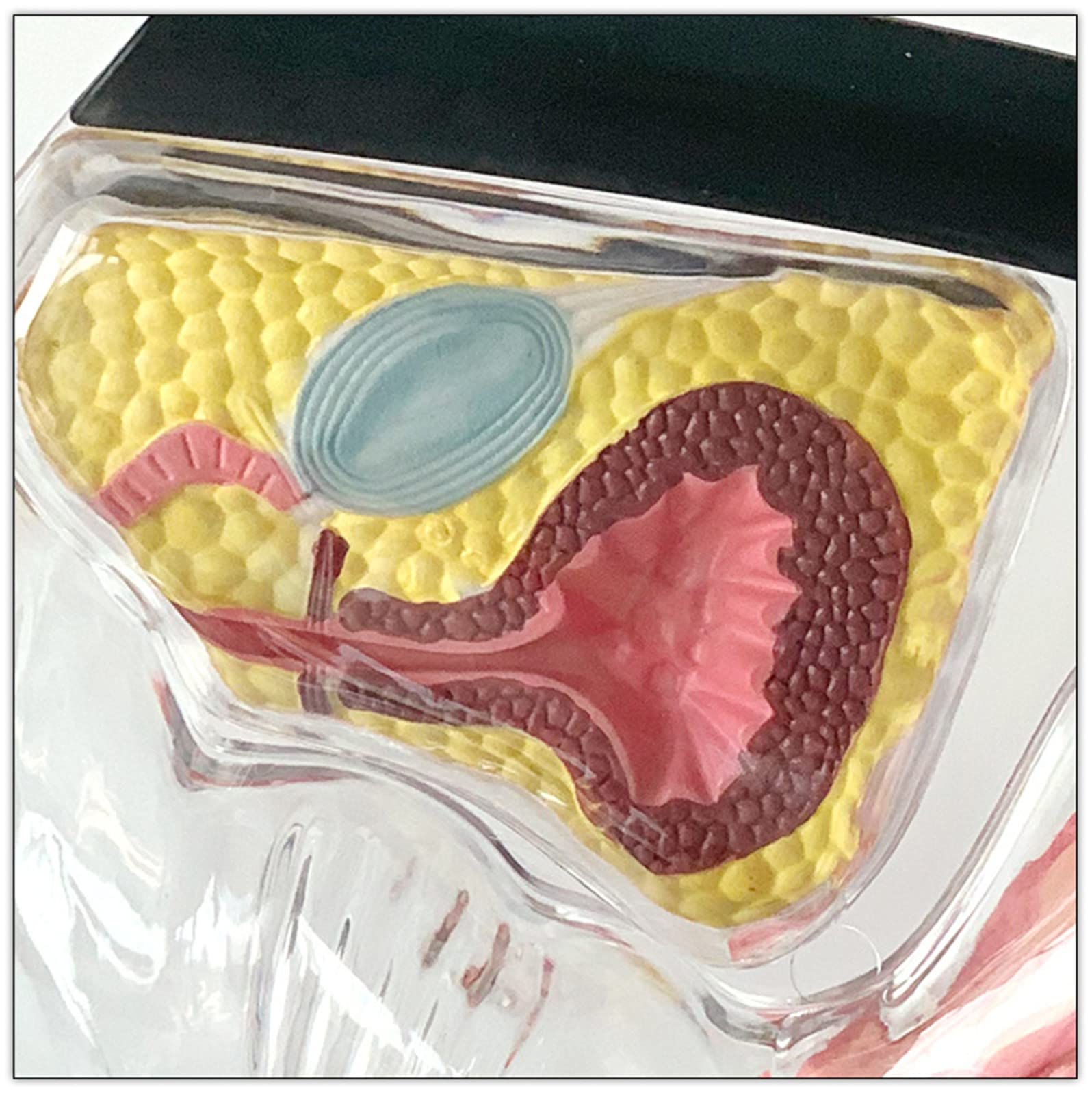 Women Reproductive System Model Transparent Uterus model Ovarian ...