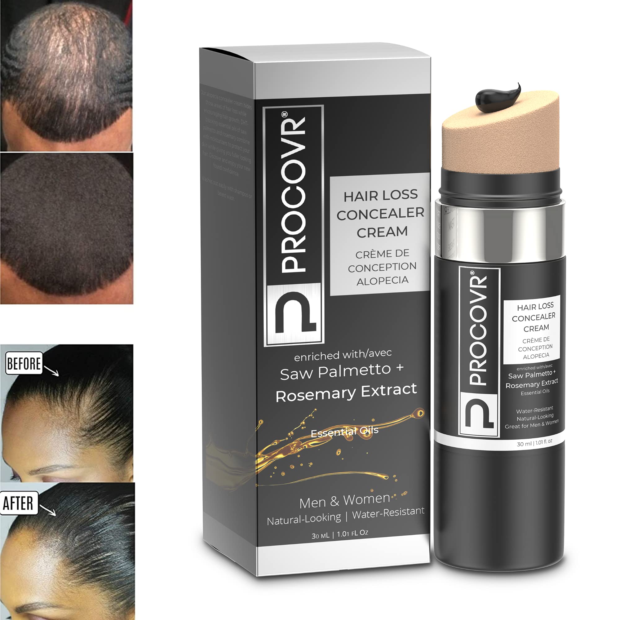 Hairline Hair Shade Scalp Concealer for Thinning & Balding with DHT ...
