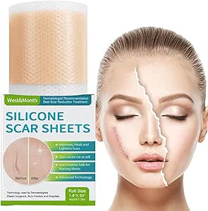 Lakan för borttagning av ärr | 1,5 meter silikon ärrborttagningsremsor ...