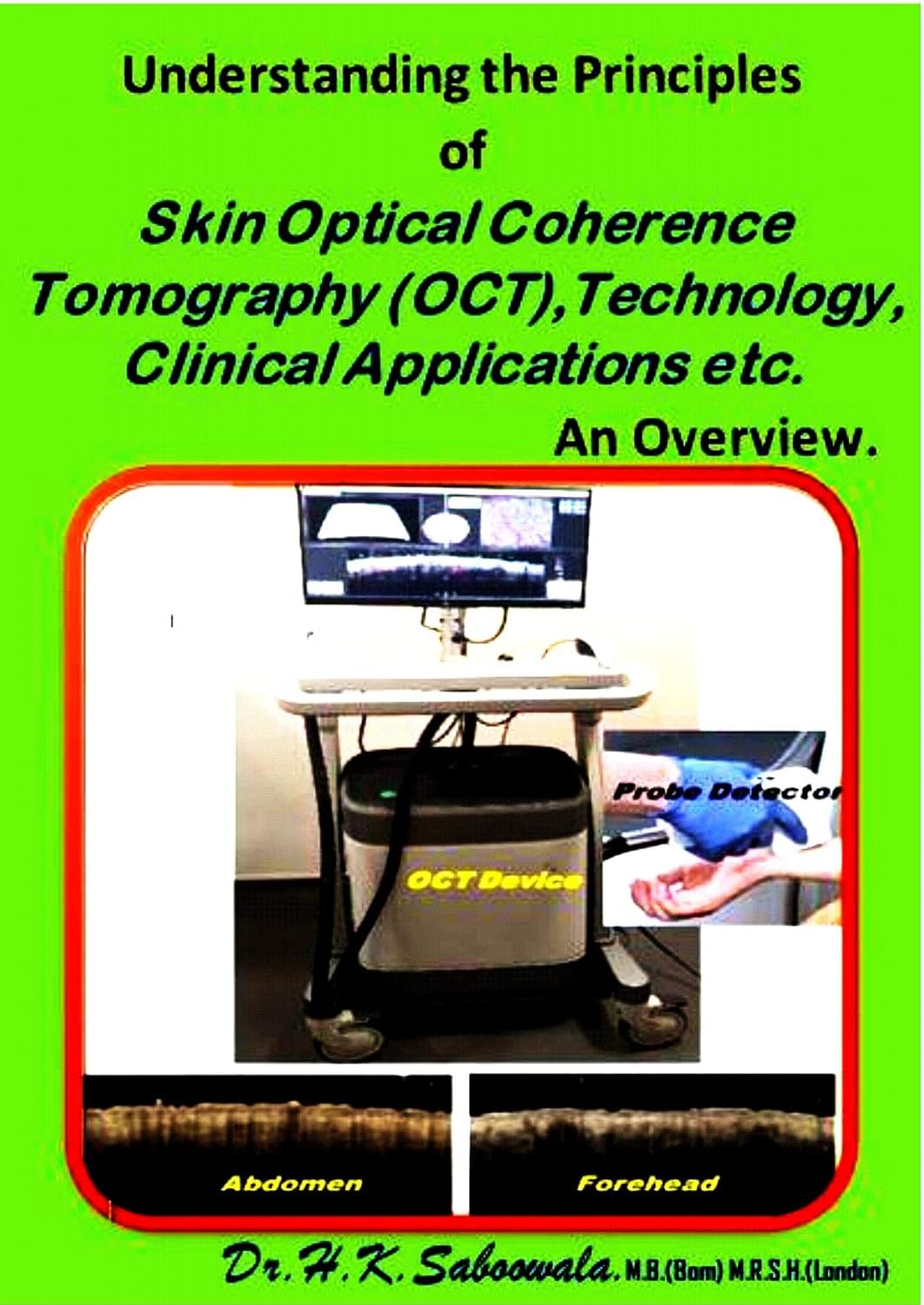 Understanding the Principles of Skin Optical Kosovo | Ubuy