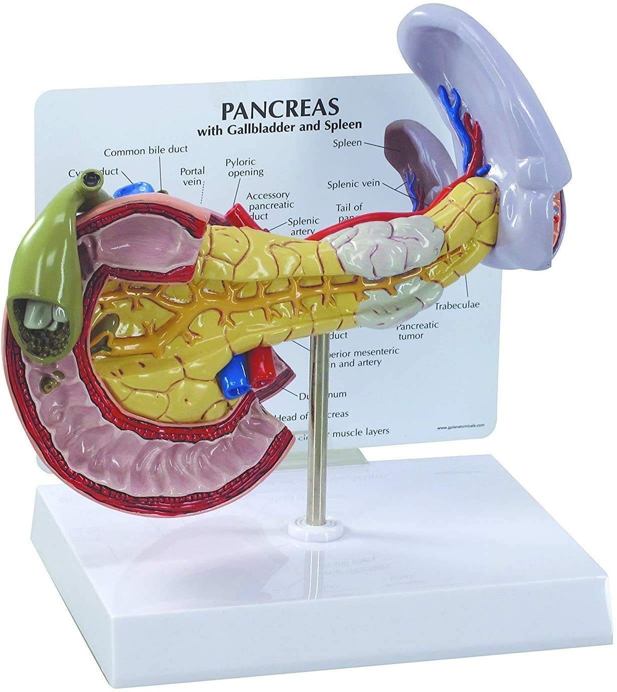 Buy Pathological Model of Spleen, pancreas, duodenum and bile, Spleen ...