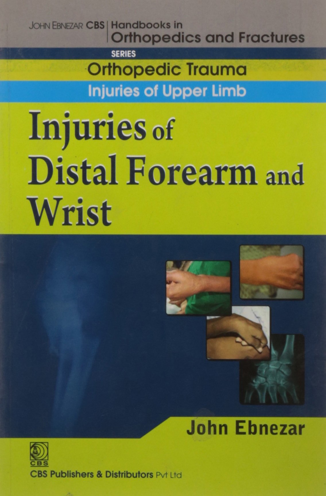 Buy INJURIES OF DISTAL FOREARM AND WRIST (HANDBOOK IN ORTHOPEDICS AND ...