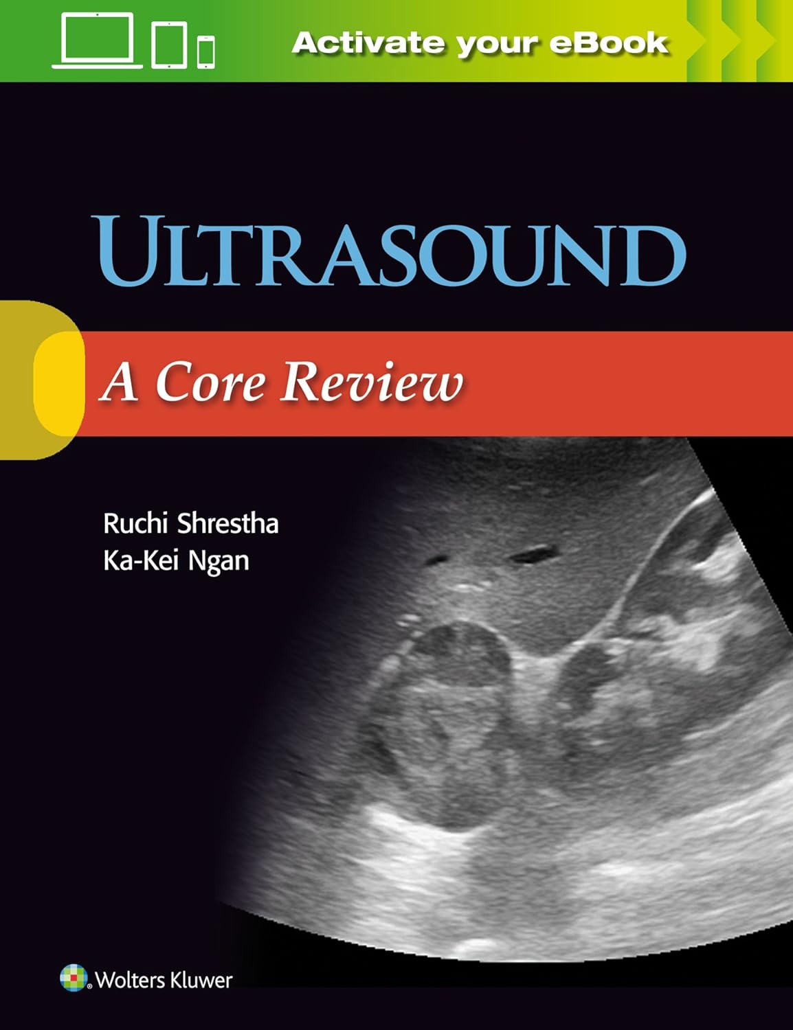 Ultrasound: A Core Review: 9781496309815: Medicine & Health Science ...