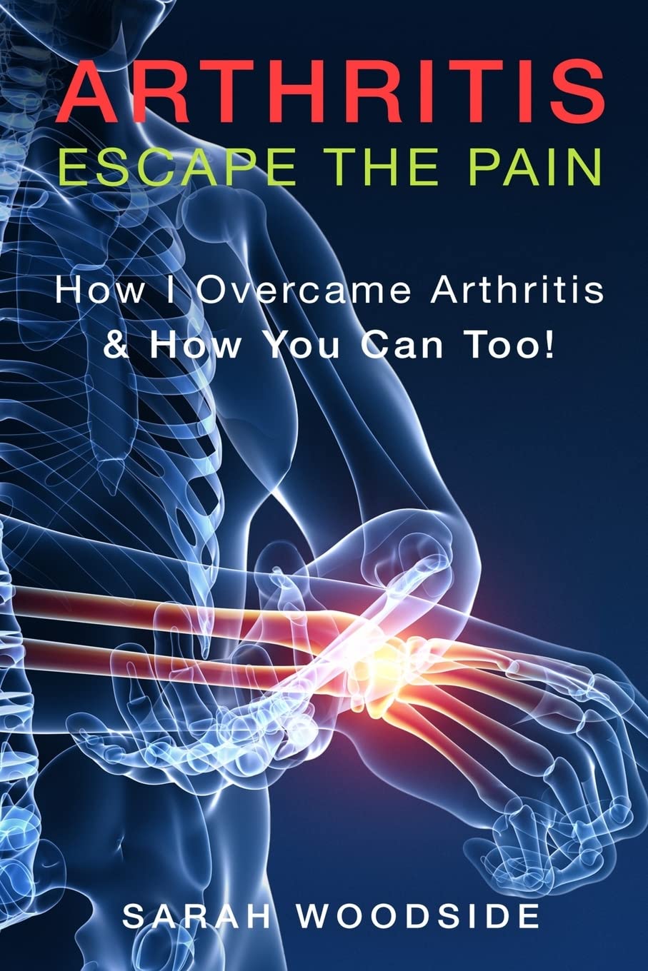 Arthritis : Escape The Pain: How I Overcame Arthritis & How You Can Too ...