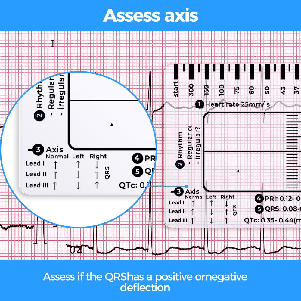 ECG 7 Step Ruler, ECG 7 Step Ruler for ECG/EKG Australia | Ubuy