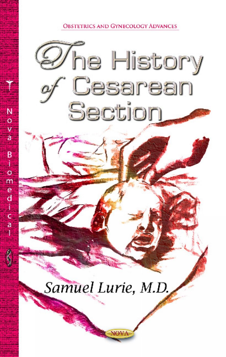 The History of Cesarean Section (Obstetrics and Gynecology Advances ...