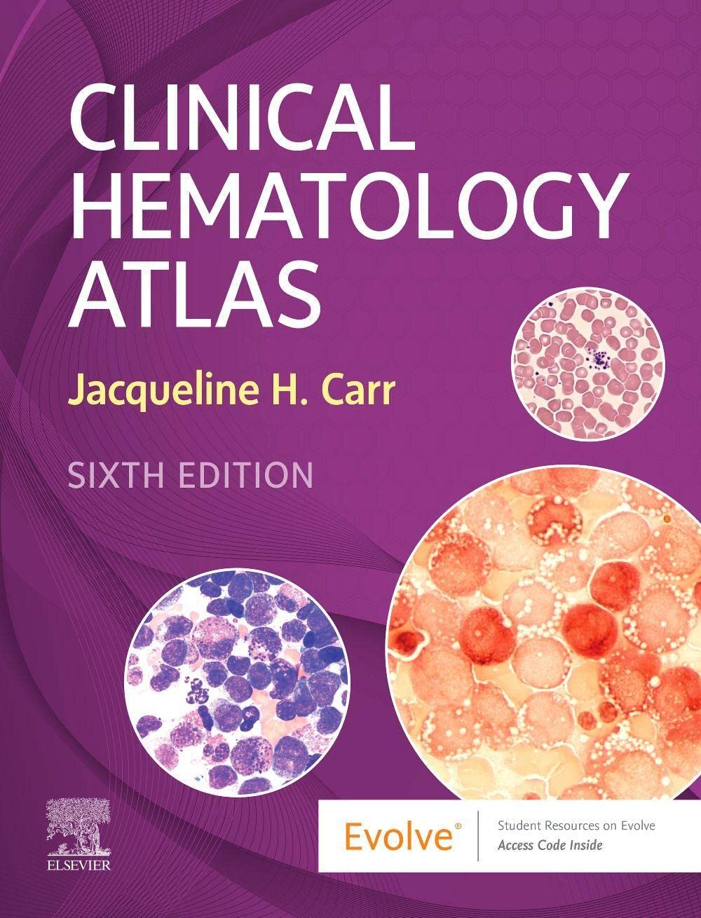 Amazon.com: Clinical Hematology Atlas: 9780323711920: Carr MS MLS ...