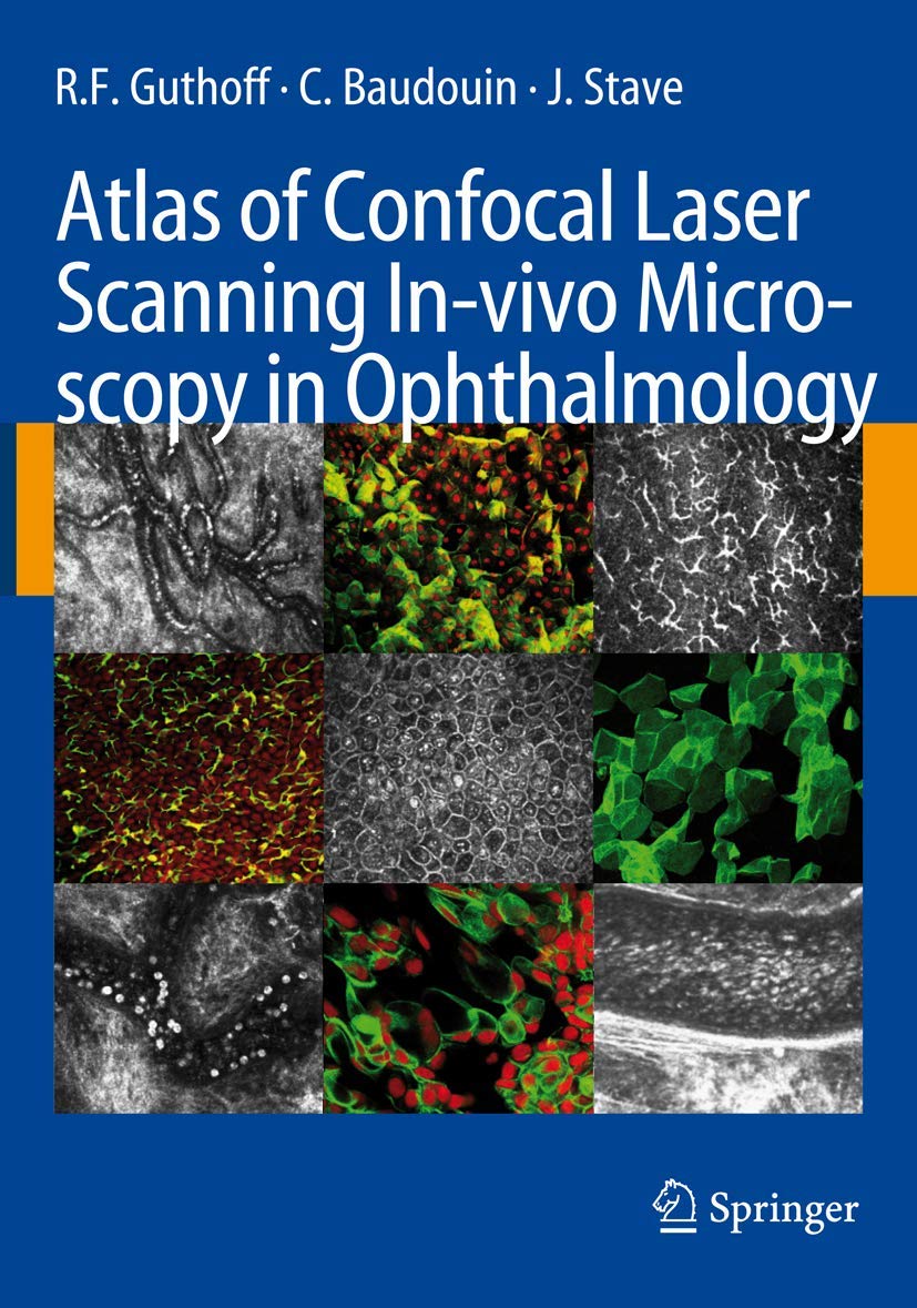 Atlas of Confocal Laser Scanning In-vivo Microscopy in Ophthalmology ...