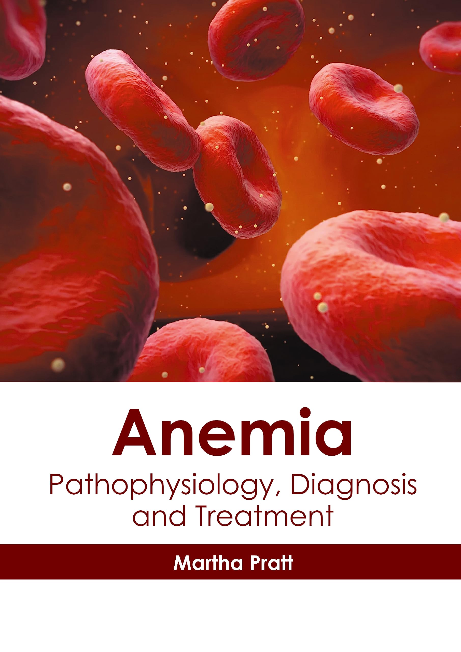 Buy ANEMIA: PATHOPHYSIOLOGY, DIAGNOSIS AND TREATMENT Book Online at Low ...