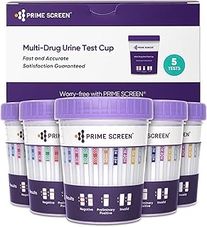 Topiramate And Urine Drug Screens: What You Need To Know | MedShun