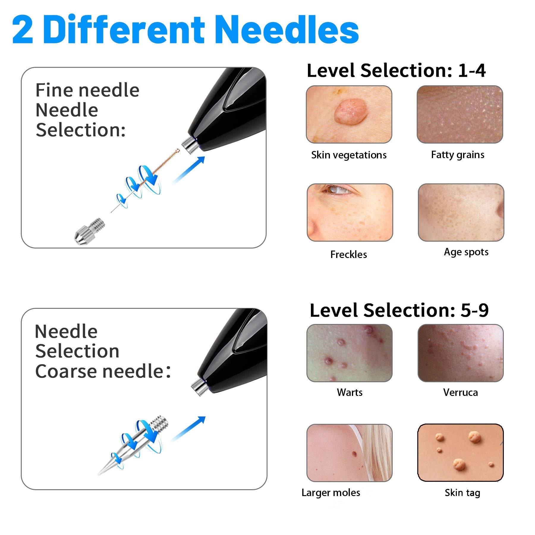 Buy CHRERNA Skin Tags Remover Pen, Portable Rechargeable Mole Remover ...