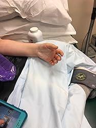 Amazon.com : Drycast Cast Comfort Itching and Odor Relief Spray - Cools ...