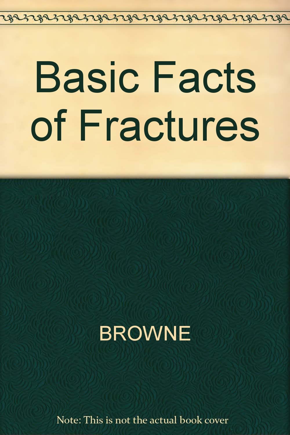 Basic Facts of Fractures: Patrick S. H. Browne (Author): 9780632008544 ...