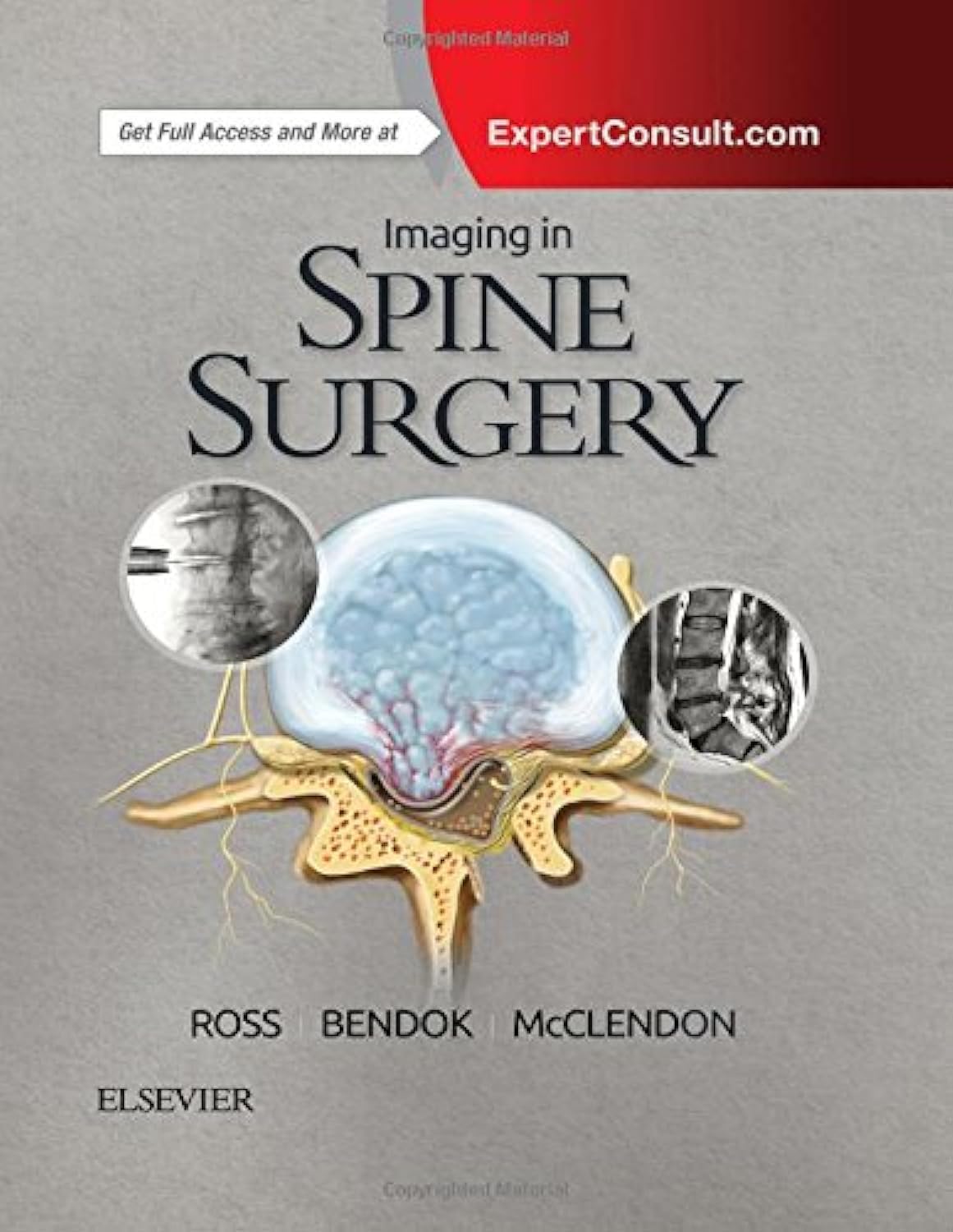 Imaging in Spine Surgery : Ross MD, Jeffrey S., Bendock MD FAANS ...
