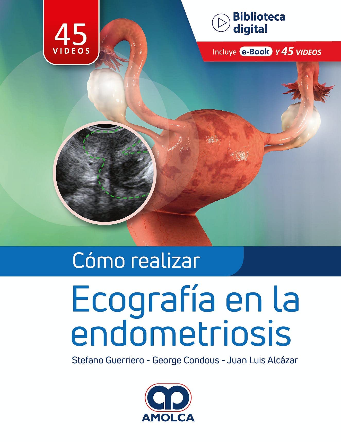 Amazon.com: Cómo Realizar Ecografía en la Endometriosis: 9789585348905 ...