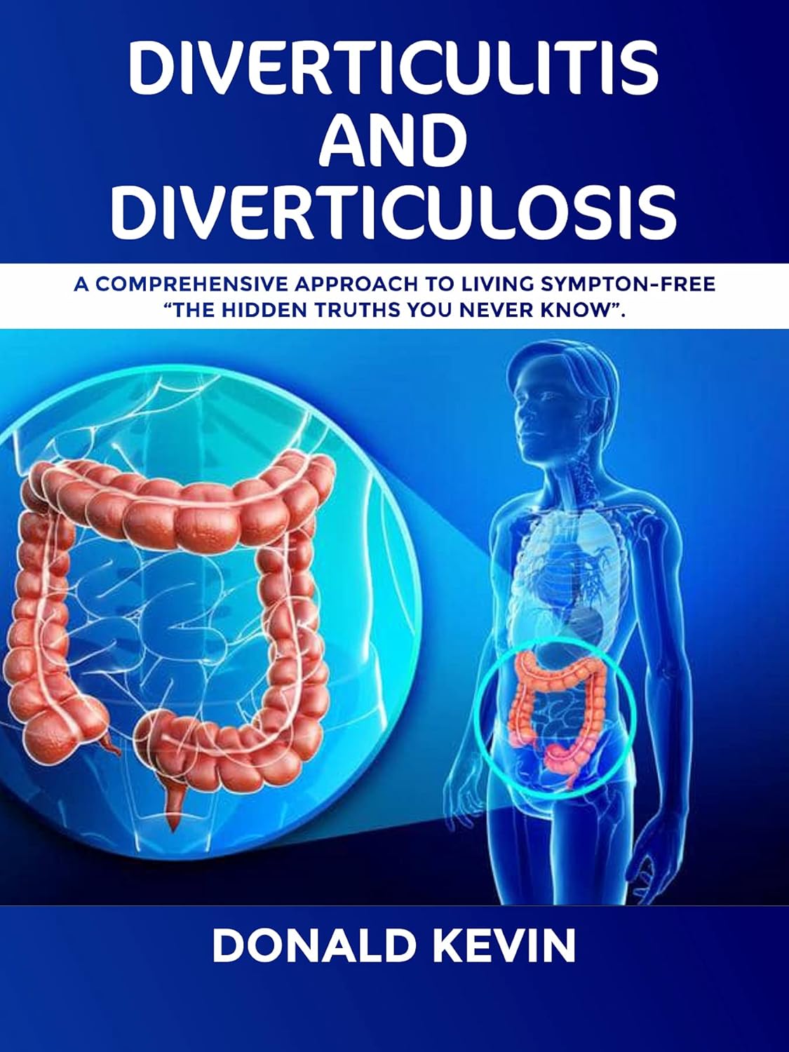 Diverticulitis and Diverticulosis: A comprehensive approach to living ...