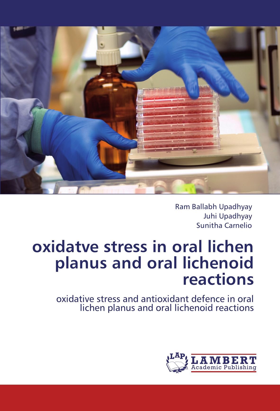 Buy oxidatve stress in oral lichen planus and oral lichenoid reactions ...