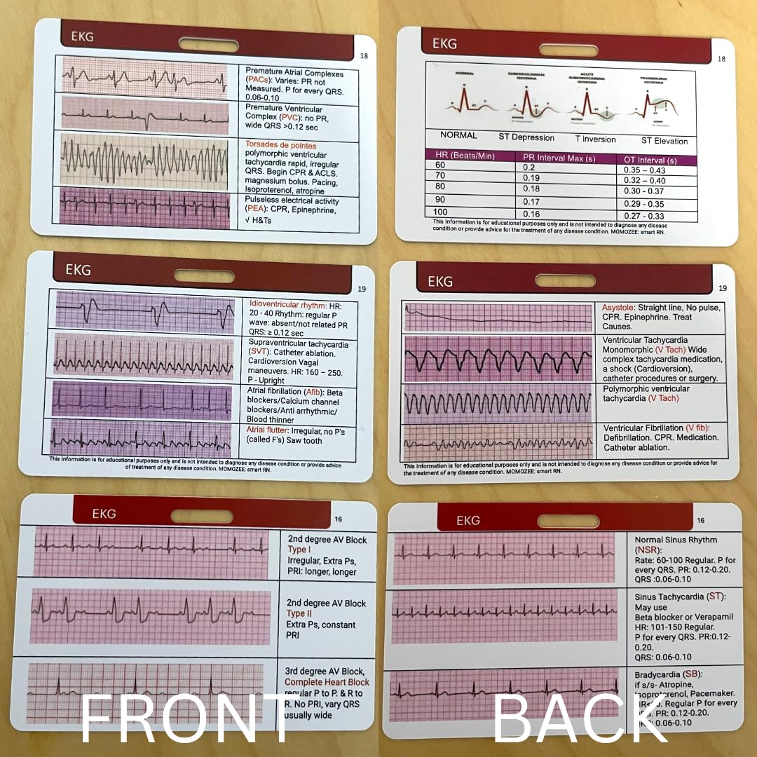 Snapklik.com : EKG Badge Card EKG Badge Buddy Nursing Reference ECG ...