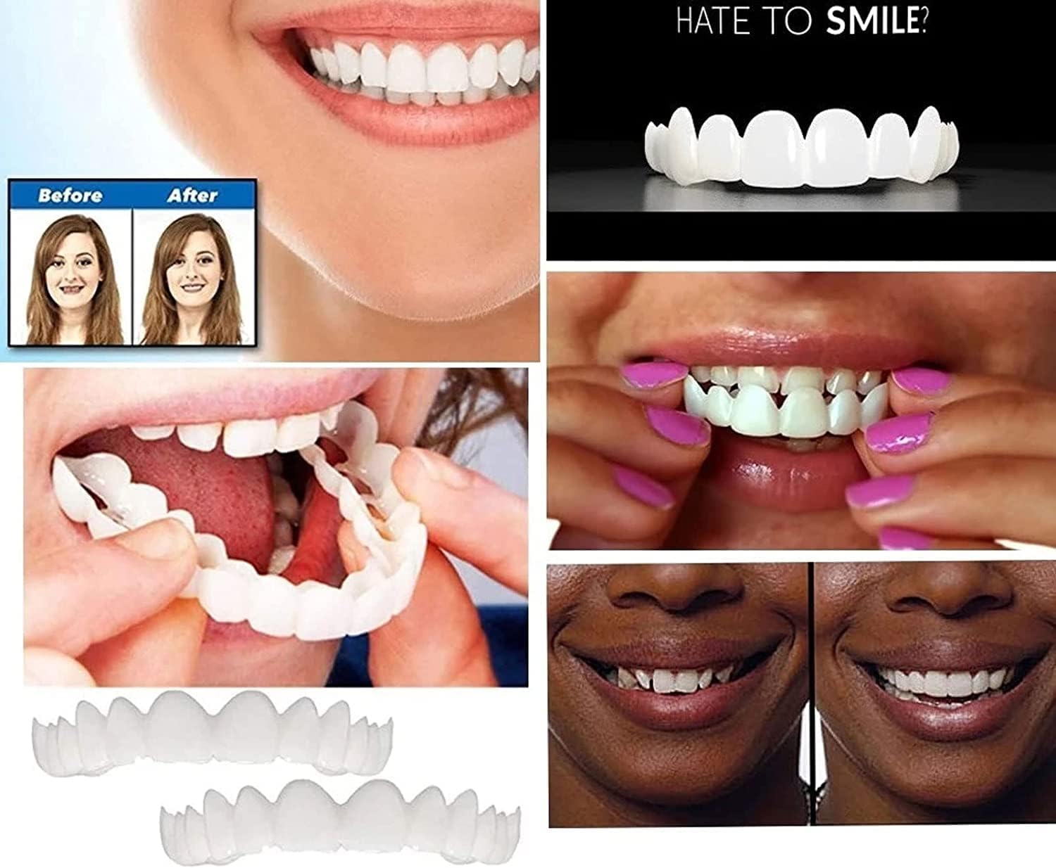 Dientes falsos, dientes dentales para mujeres y hombres, carillas ...