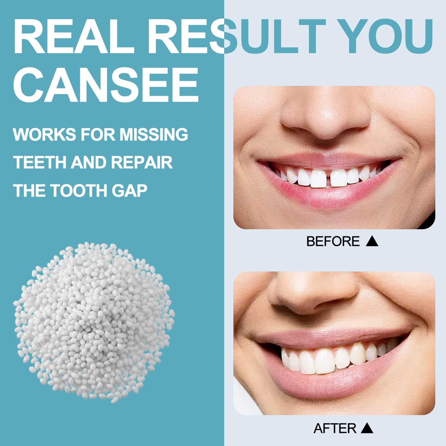 Buy Temporary Tooth Repair kit for Filling The Missing Broken Tooth and ...