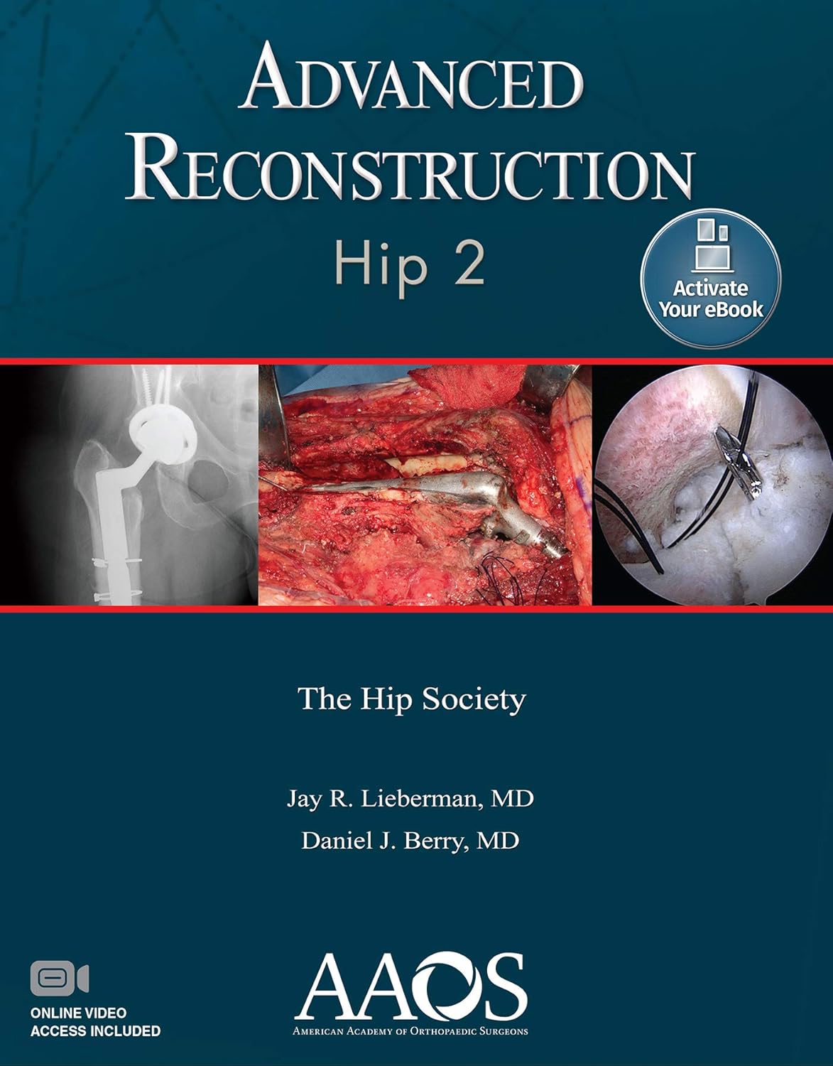 Buy ADVANCED RECONSTRUCTION HIP 2 THE HIP SOCIETY (PB 2017) Book Online ...
