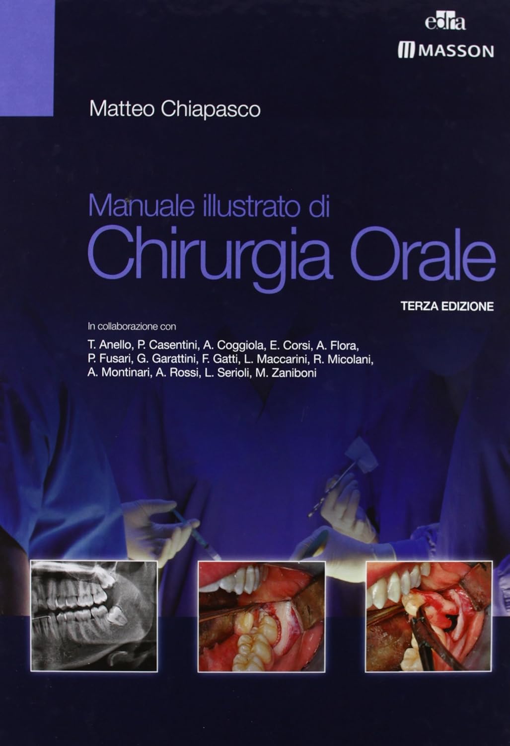 Amazon.com: Manuale illustrato di chirurgia orale: 9788821434693 ...