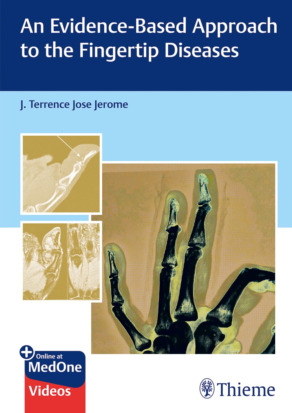 An Evidence-Based Approach to the Fingertip Diseases: 9789392819360 ...