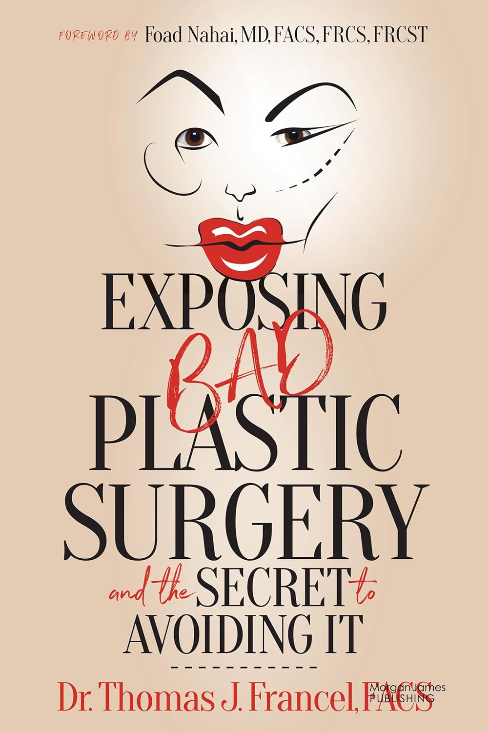 Exposing Bad Plastic Surgery: and the Secret to Avoiding It : Francel ...