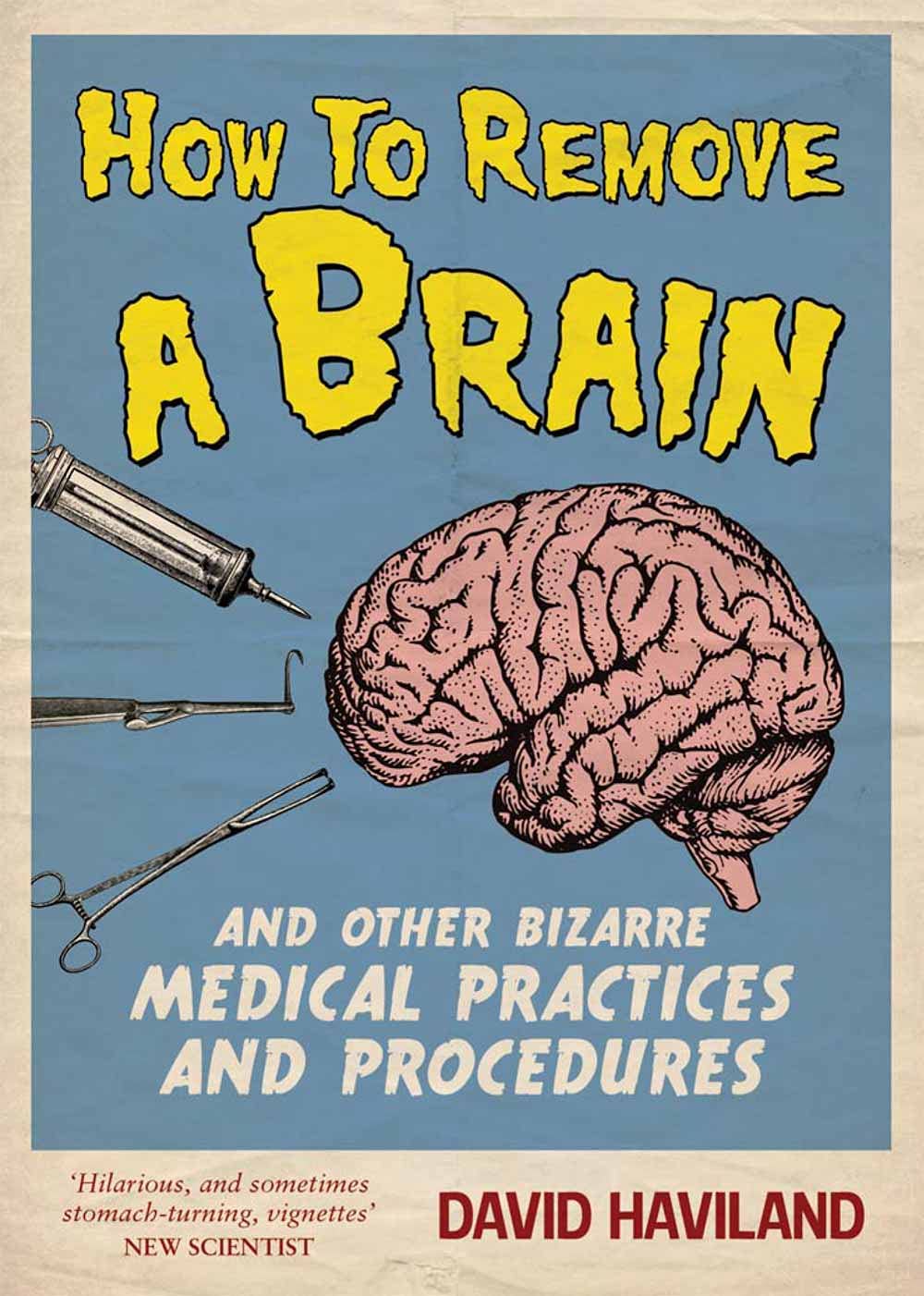 How to Remove a Brain: And Other Bizarre Medical Practices: Amazon.co ...
