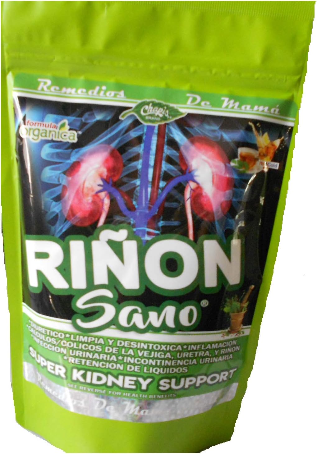 Amazon.com : Riñon Sano / Super Kidney Support. Organic Herbal Tea. Net ...