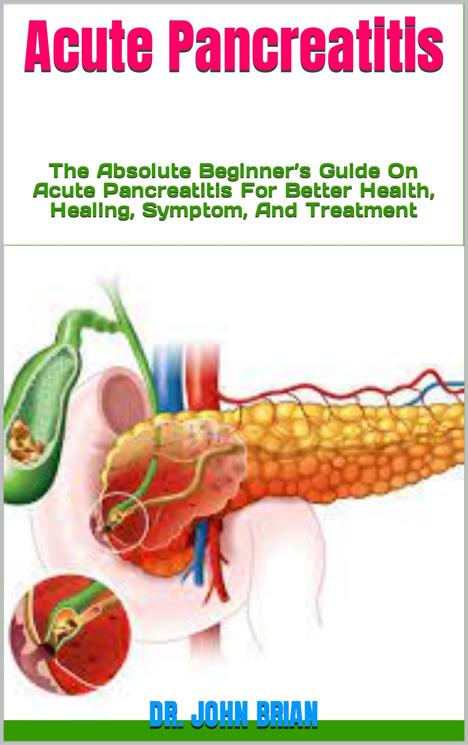 Buy Acute Pancreatitis : The Absolute Beginner’s Guide On Acute ...