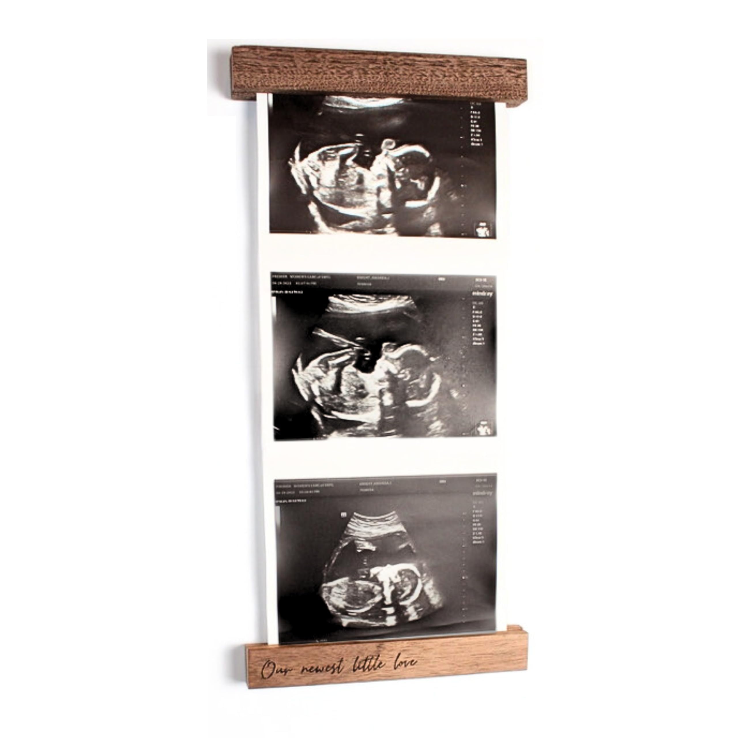 Amazon.com: Ultrasound Picture Frames - Magnetic Picture Frame for ...
