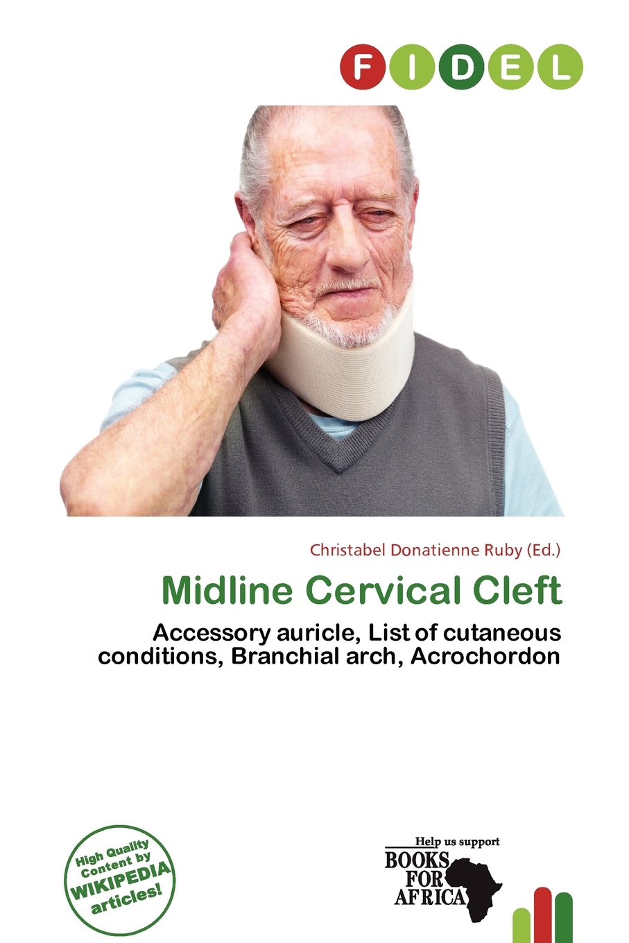 Amazon.co.jp: Midline Cervical Cleft : 本
