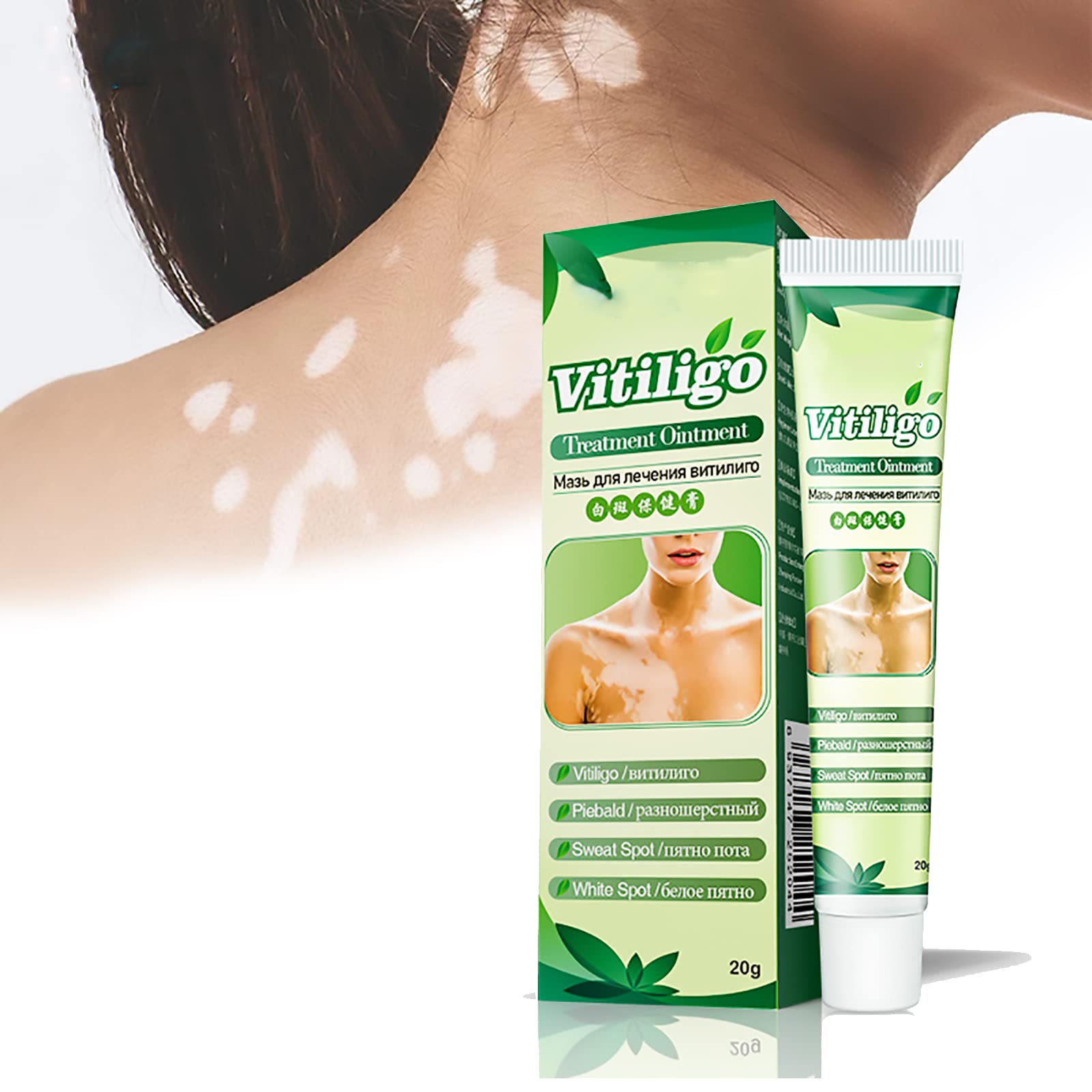 Lmzd White Tag Treatment Moisturizing Cream Vitiligo Care Cream Skin ...