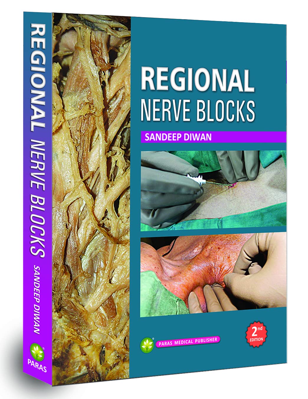 Regional Nerve Blocks: Sandeep Diwan: 9788181915467: Amazon.com: Books
