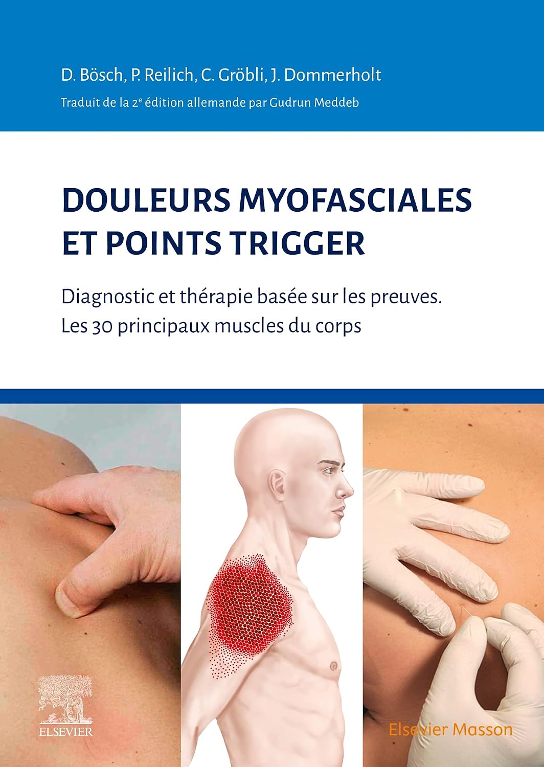 Douleurs myofasciales et points trigger: Diagnostic et thérapie basée ...