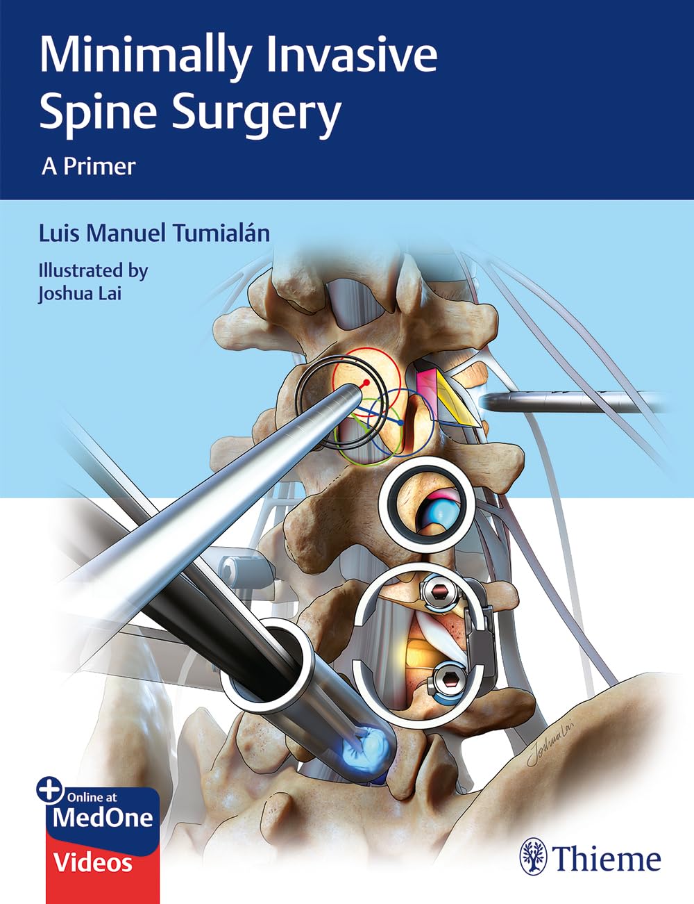 Minimally Invasive Spine Surgery: A Primer: 9781626232181: Medicine ...