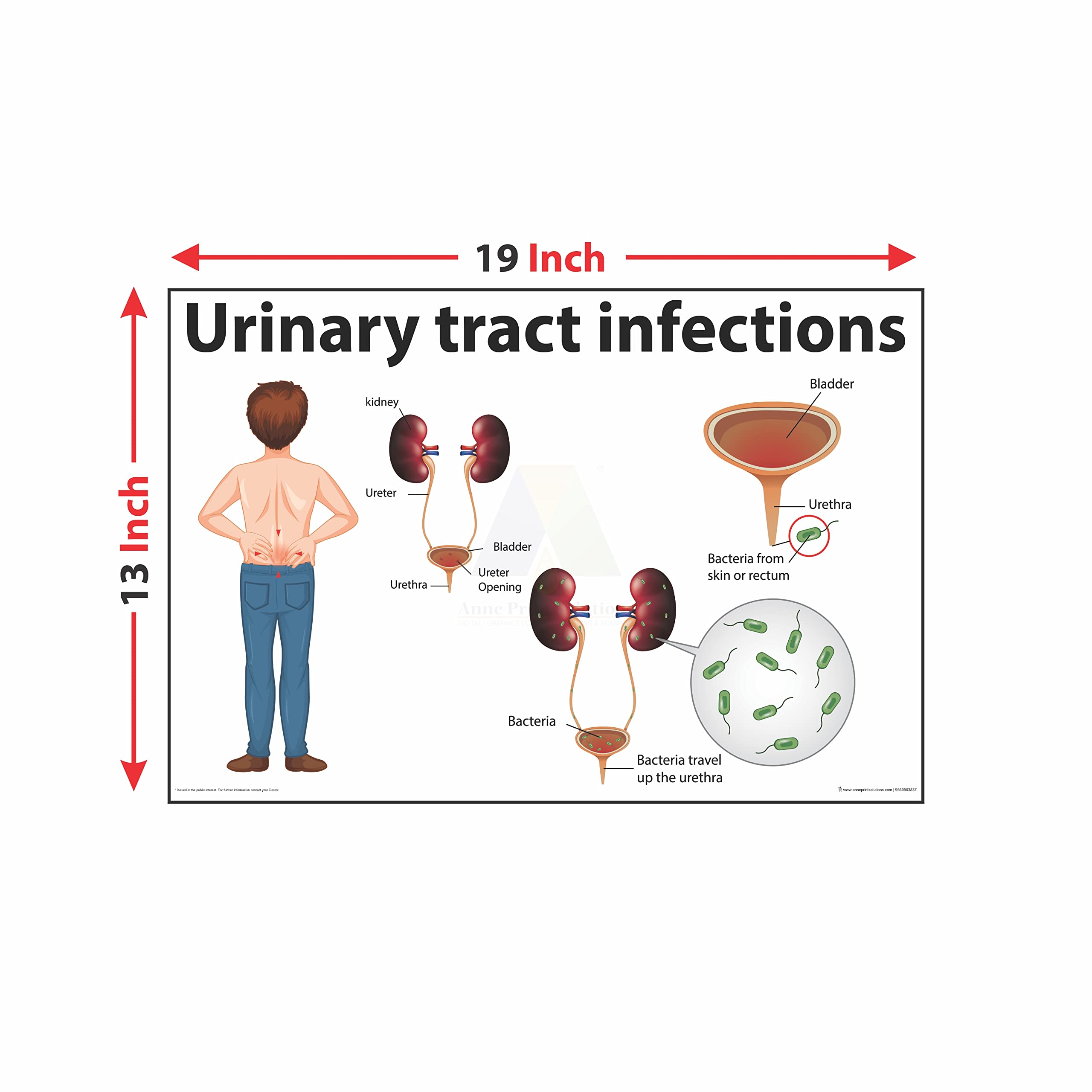 Chart Of Urinary Tract Infection Financially